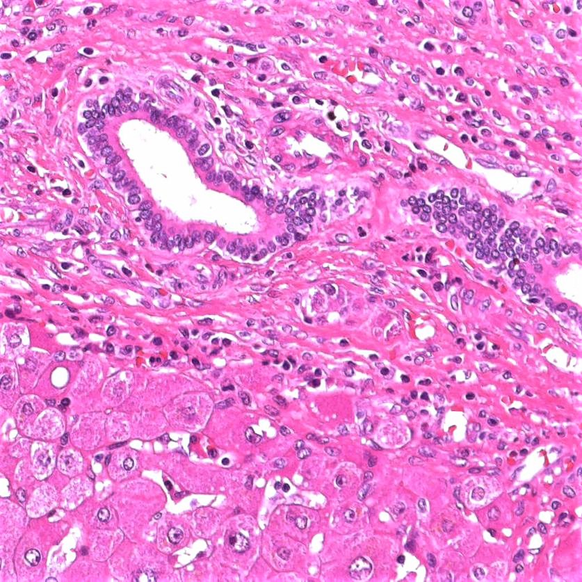 Ematossilina di Gill 2 | 01HEMG21000 | Histoline